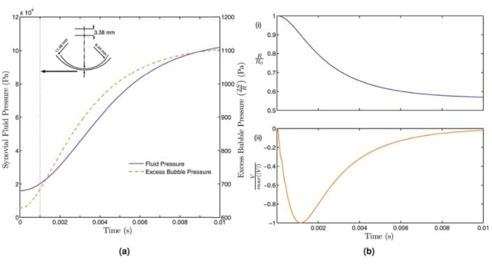 How math and engineering helped study knuckle cracking - Engineering ...